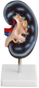 MLE Kidney Model (1 Part) - Urinary System Model Science Project Kit ...